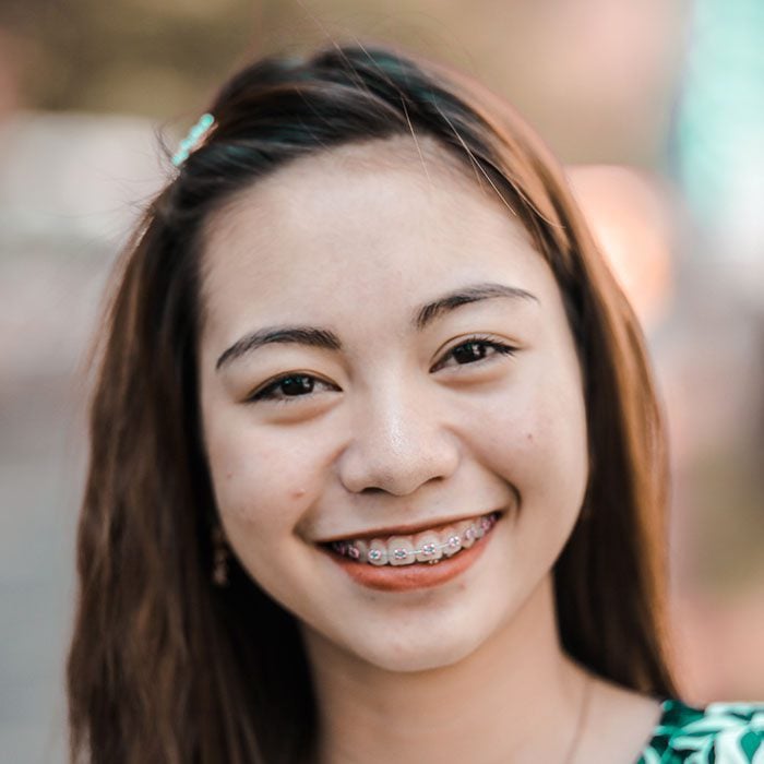 Crooked Teeth Can Cause Speech Problems My Dental Practice Website crooked-teeth-can-cause-speech-problems-my-dental-practice-website